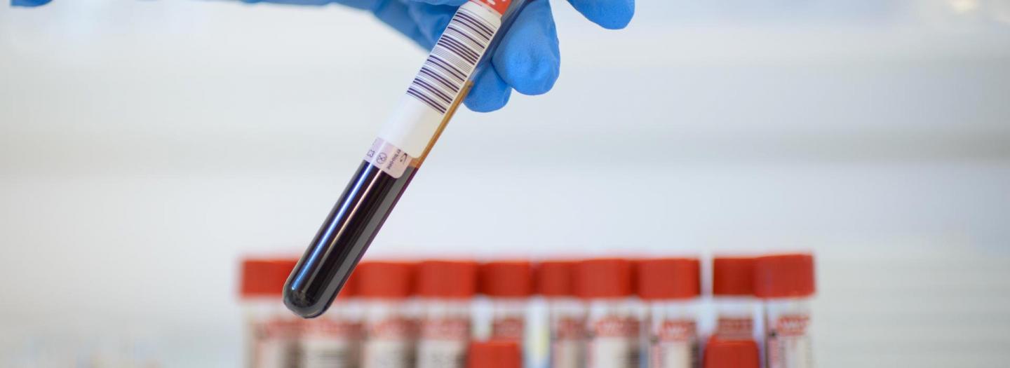 Medicina de laborator la „Providenţa” | Providența - Policlinică și Spital